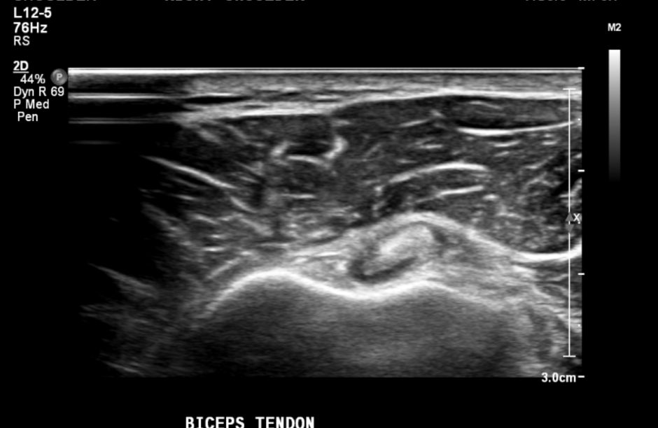 Ultrasound - Radius Imaging