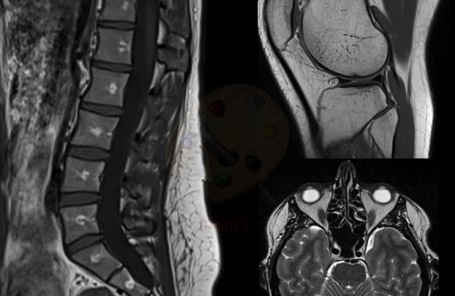 Magnetic Resonance Imaging (MRI) - Radius Imaging