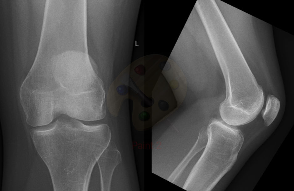 Digital X-Ray - Radius Imaging